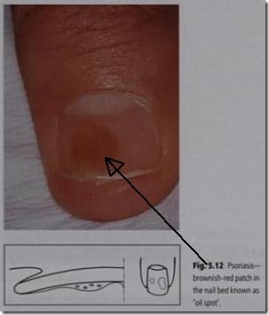 Medicine Decoded: what is the diagnosis?